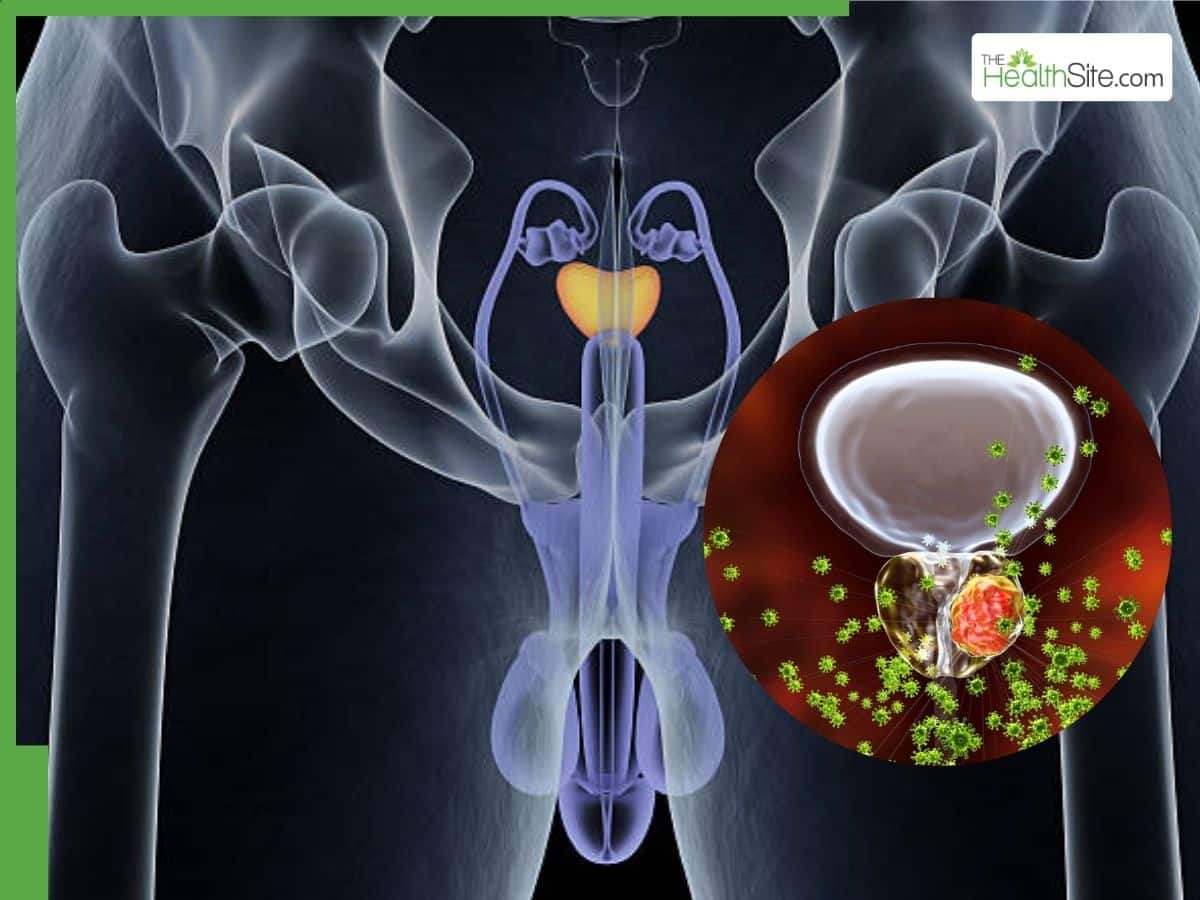 Age And Prostate Health: What Every Decade Means For Your Prostate ...