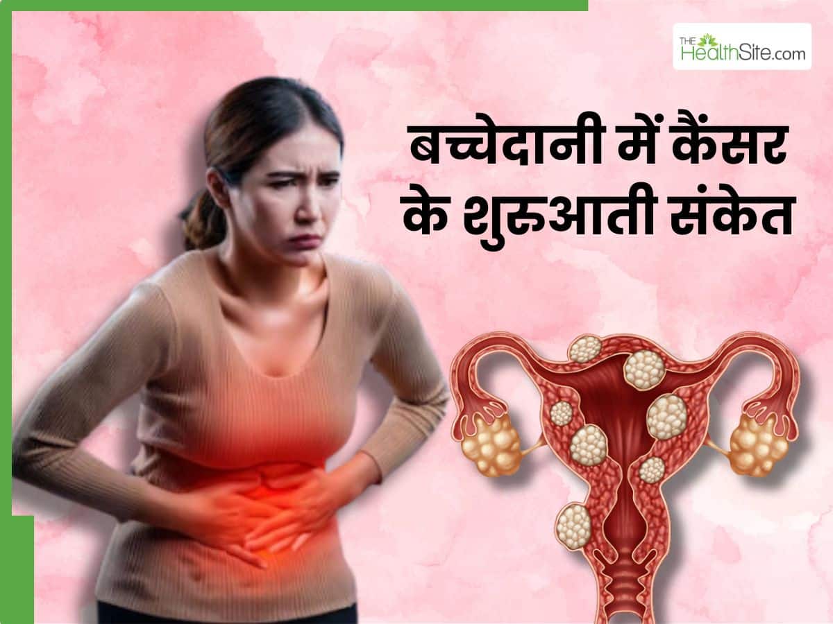 Bacchedani Me Cancer ke Lakshan | बच्चेदानी में कैंसर होने के शुरुआती ...