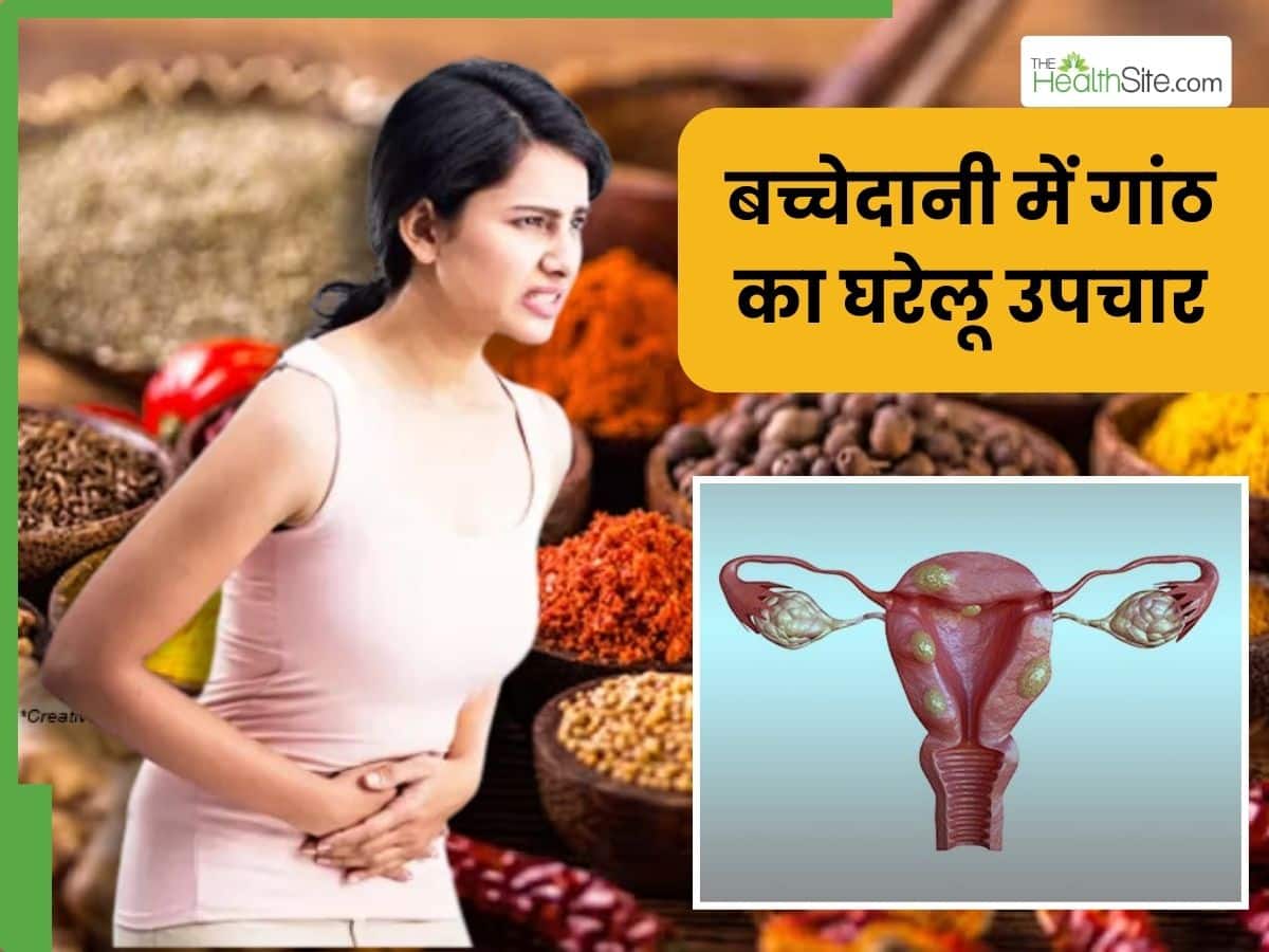 Bachedani Me Ganth Ka Ilaj | बच्चेदानी में गांठ होने पर अपनाएं ये 5 ...
