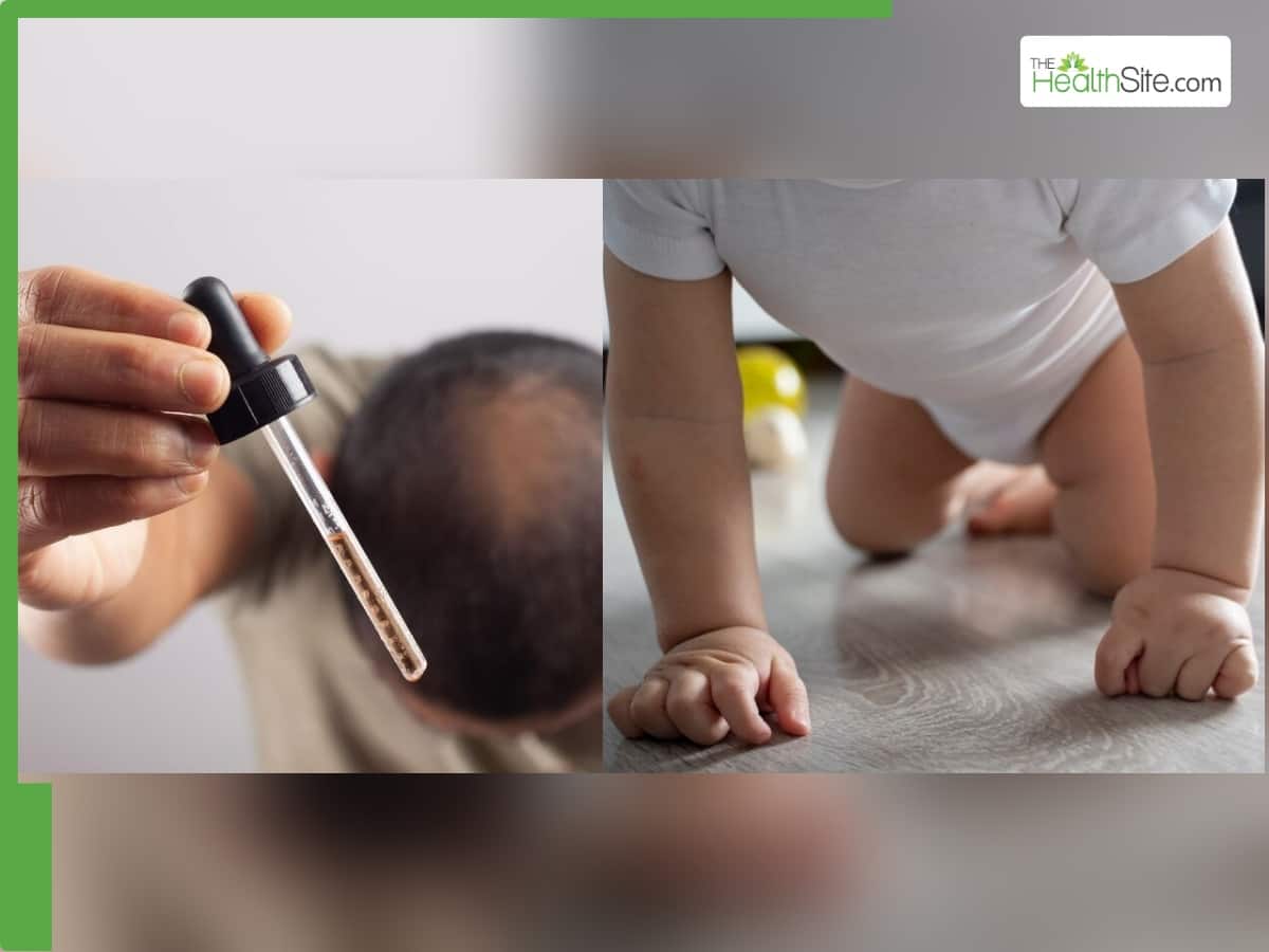 How Did 11 Babies In Europe End Up With Hypertrichosis Or 'Werewolf ...