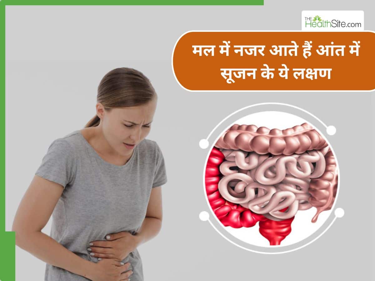 Aant Me Sujan Ke Lakshan | आंत में सूजन होने पर सुबह टॉयलेट में नजर आते ...