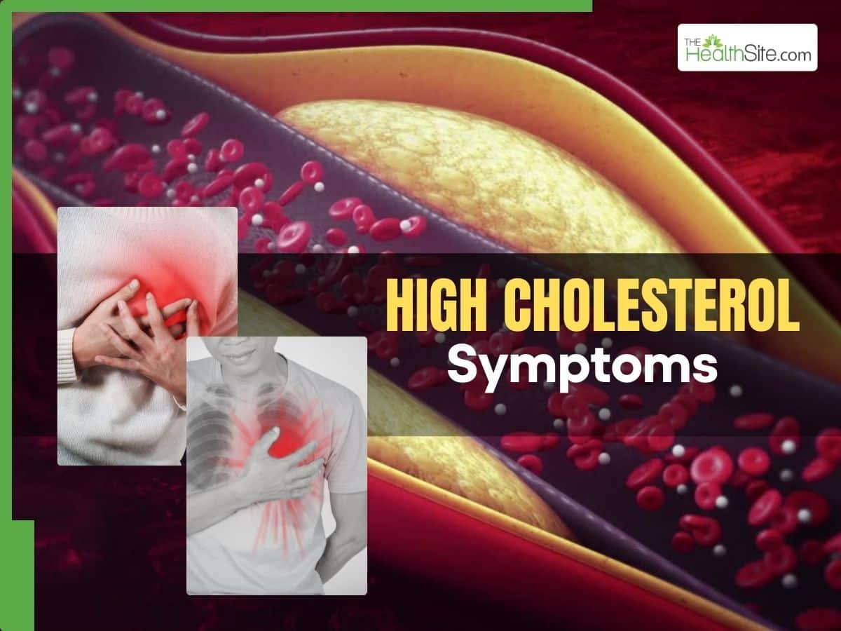 10 Signs Your High Cholesterol Levels Have Gone Out of Control ...