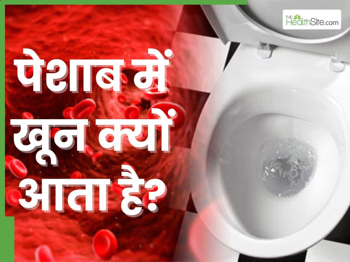 Peshab Se Khoon Aane Ke Karan | इन 5 खतरनाक बीमारियों की वजह से पेशाब ...