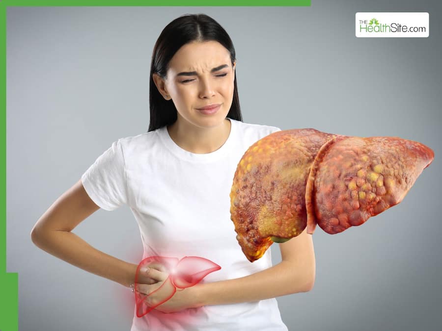 Diet For Fatty Liver Patients: 10 Foods You Must Avoid When Your Liver ...