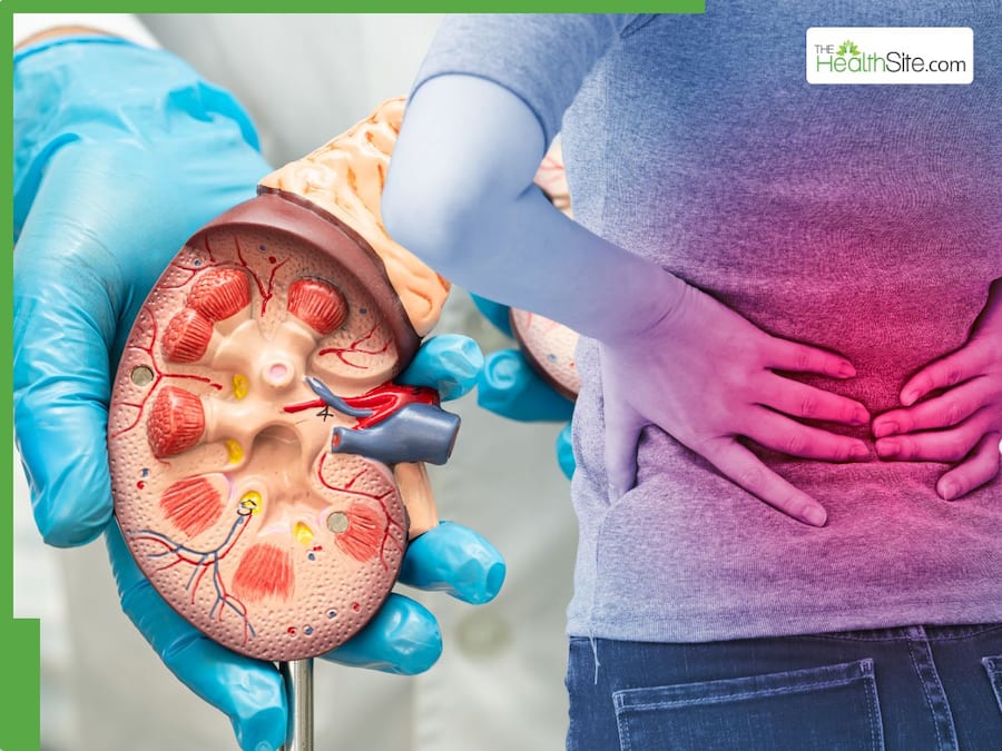 Kidney Damage Signs: 7 Indicators on Your Hands That Say Your Kidneys ...