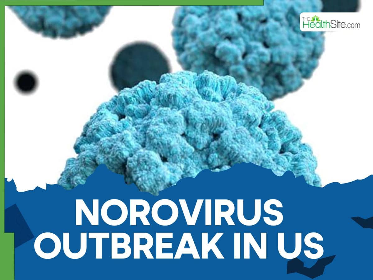 Norovirus Cases Surge In the US: Know The Symptoms, Causes, And How To Protect Yourself ...