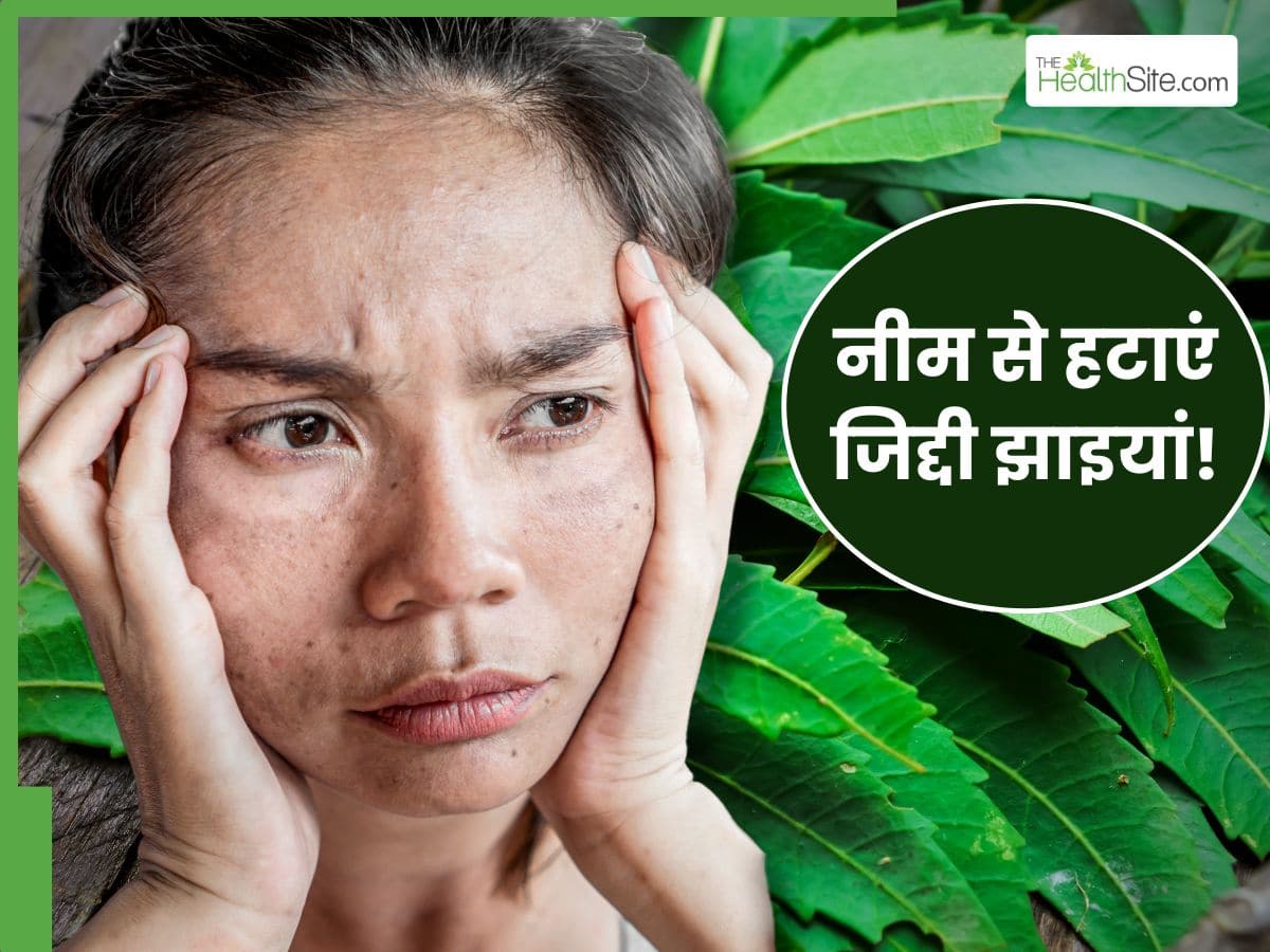 Neem se Jhaiya Kaise Hataye | जिद्दी झाइयां हटाने के लिए नीम की ...