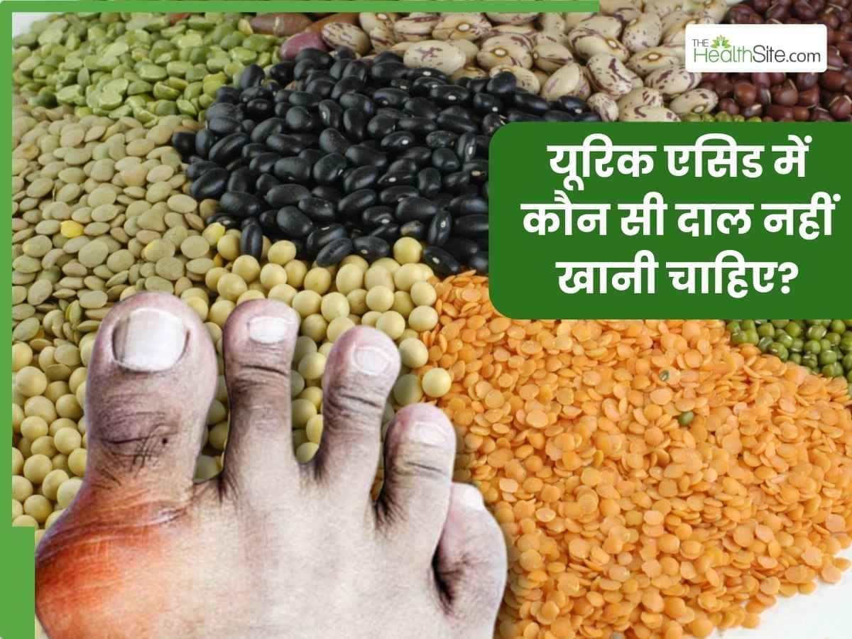 Uric Acid Me Kaun Si Dal Nahi Khani Chahiye यूरिक एसिड बढ़ा हुआ है तो