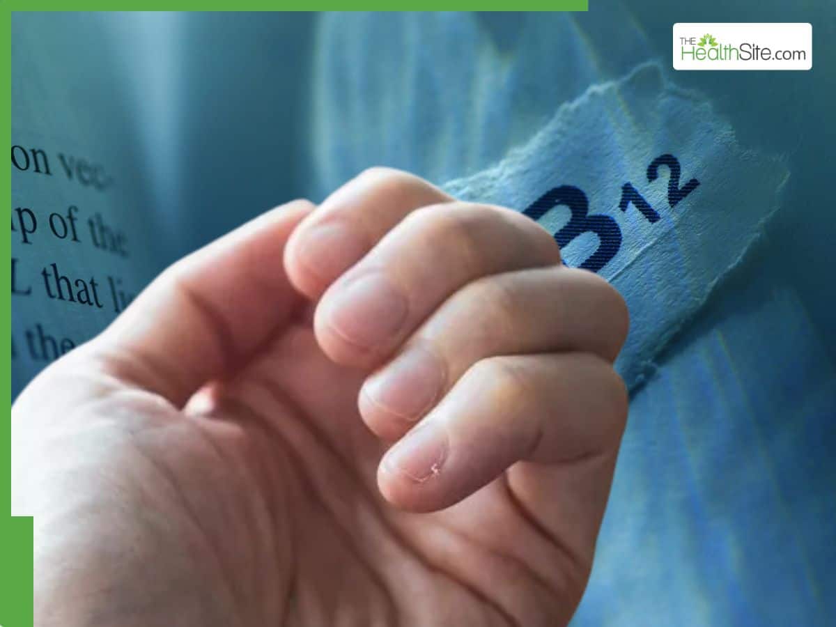 Vitamin B12 Deficiency Signs On Nails: 7 Indicators You Don't Have ...