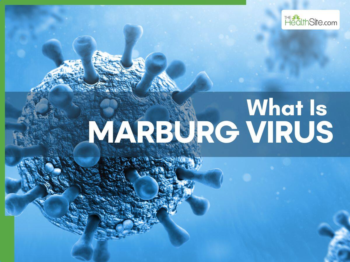 What Is Marburg Virus? Symptoms of Deadly Bleeding Eye Virus You Should ...