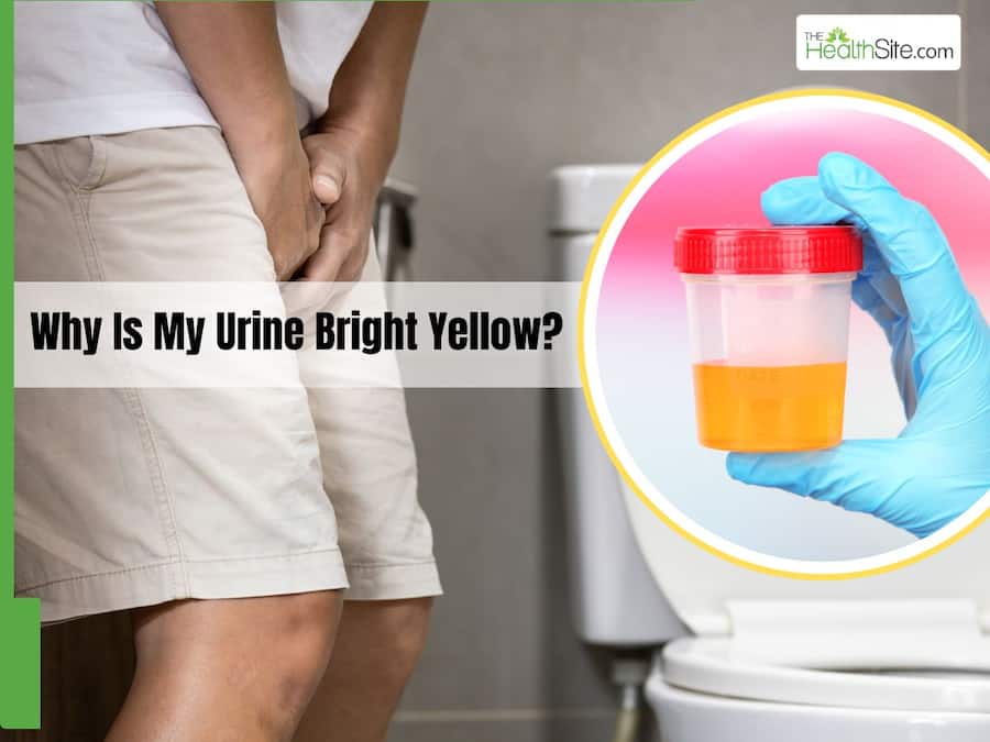 Why Is My Urine Bright Yellow? Here's What Your Urine Is Telling You ...