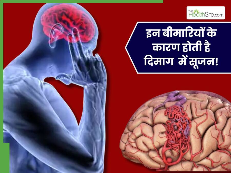 Dimag Me Sujan ke Karan | इन 5 बीमारियों के कारण दिमाग में होने लगती है ...