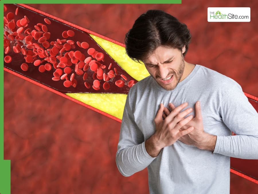 Signs of Poor Heart Health: 5 Warning Signs Your LDL High Cholesterol ...