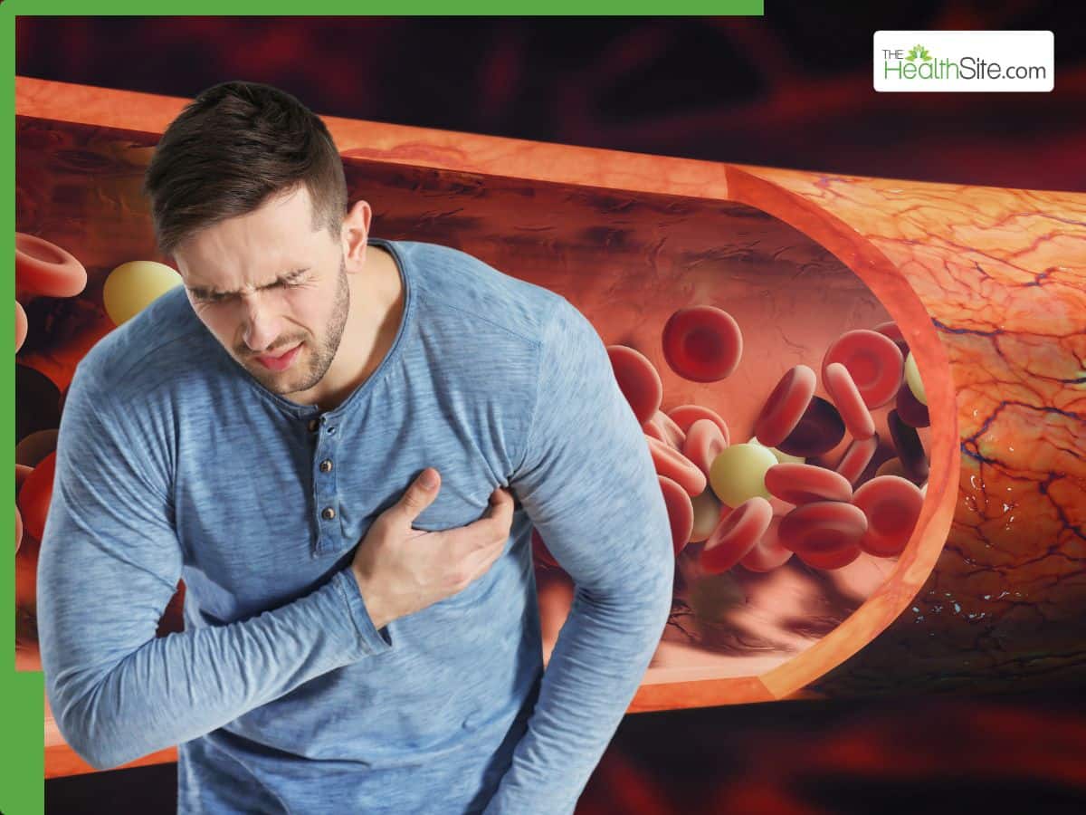 High Cholesterol Side Effects: 10 Signs Your Bad Cholesterol LDL Levels ...