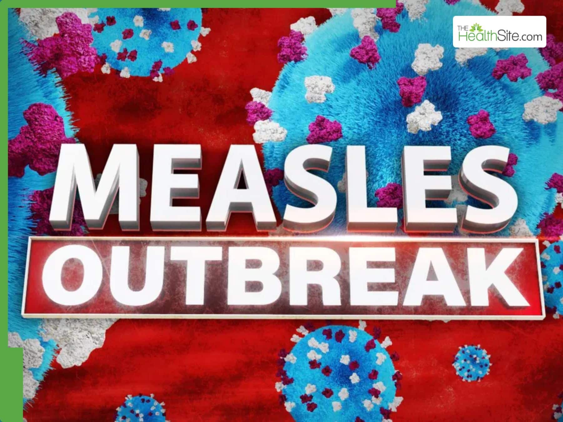 Measles Outbreak Sweeps Through US, Over 130 Infected; Texas Reports ...