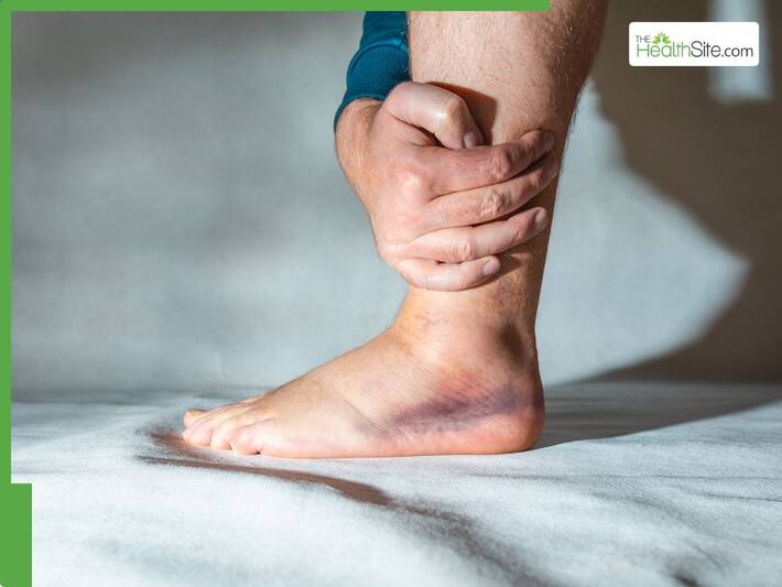 Clogged Arteries Symptoms: 7 Unusual Signs of Heart Blockage That ...