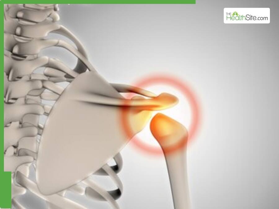 Shoulder Dislocation: Understanding The Severity Of The Injury And Its ...