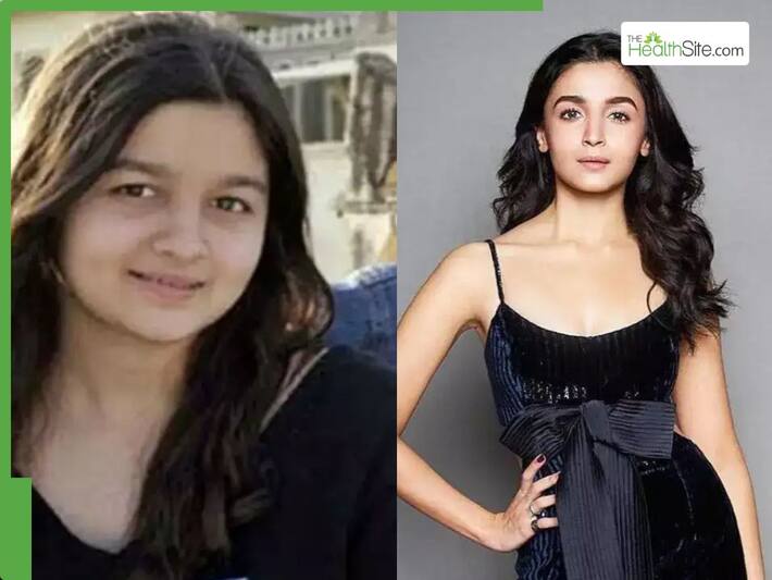 Anant Ambani to Alia Bhatt: 5 Famous Indian Celebrity Weight Loss ...