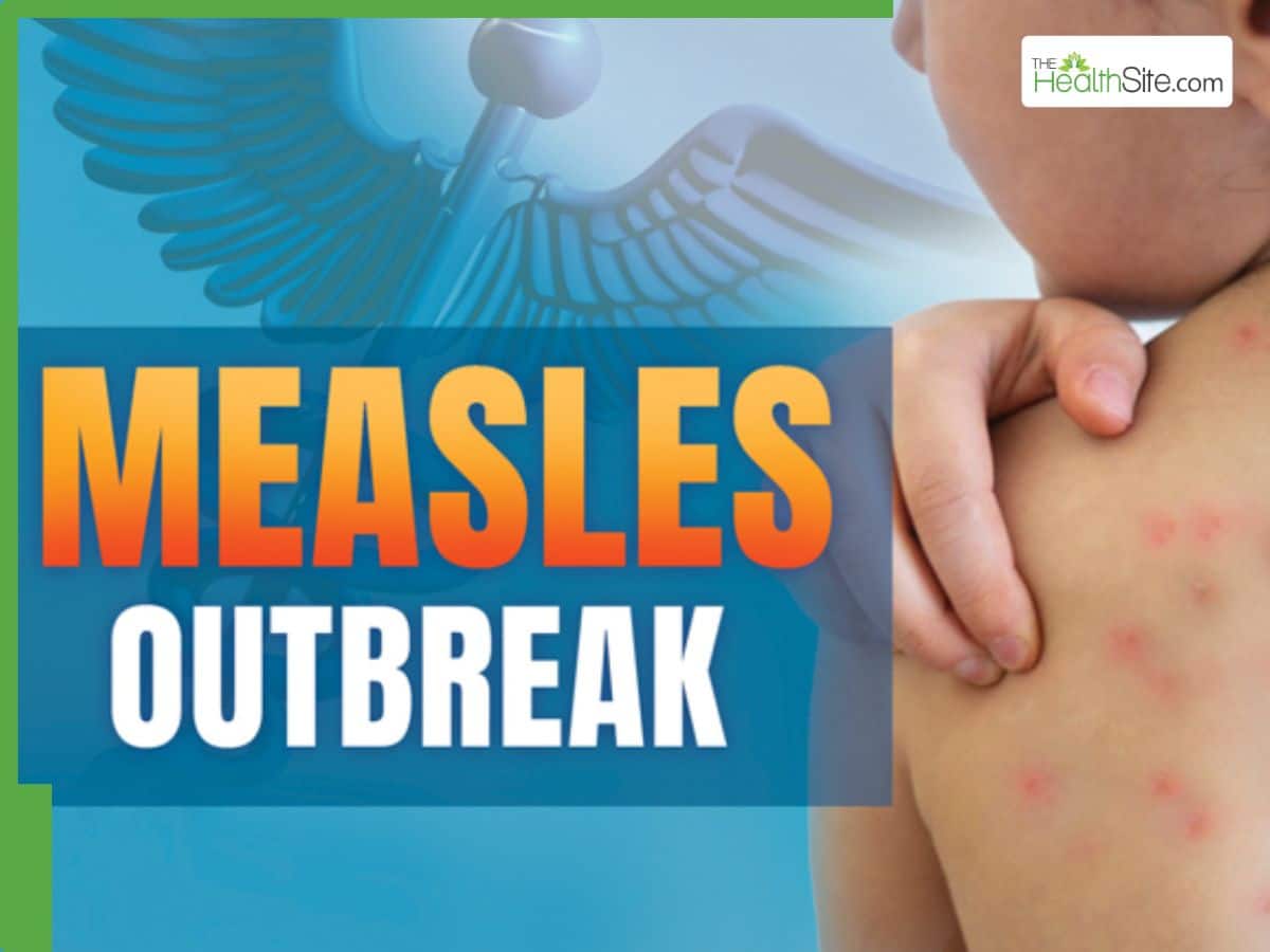 Measles Outbreak In US: Texas On High Alert After Unvaccinated Man Dies ...