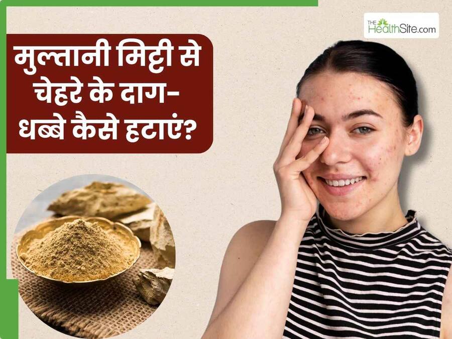 Multani Mitti Se Chehre Ke Daag Dhabbe Kaise Hataye | चेहरे के दाग-धब्बे हटाने के लिए मुल्तानी ...