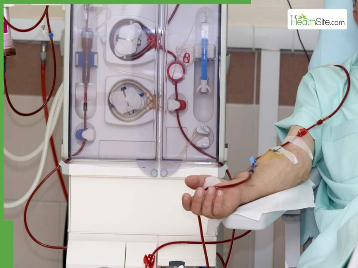 Renal Replacement Therapy: What You Need To Know | TheHealthSite.com