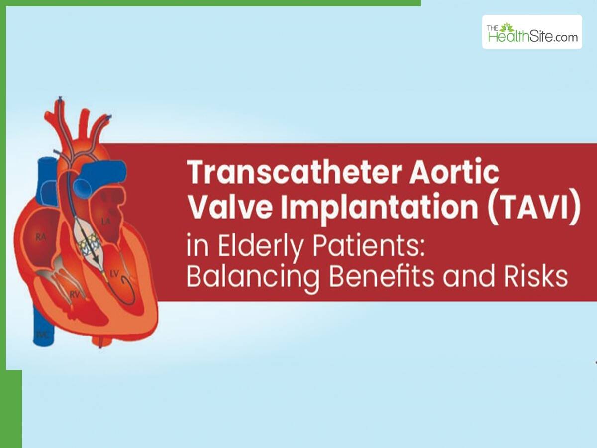TAVI: A Safe Heart Treatment Option For Seniors | TheHealthSite.com