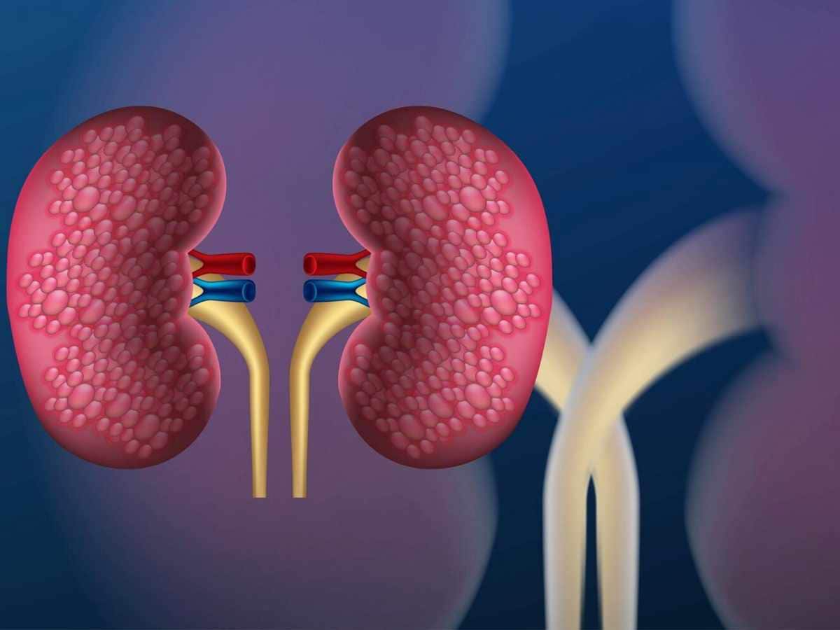 Kidney Health In Women: Understanding The Risks And Importance Of Early ...