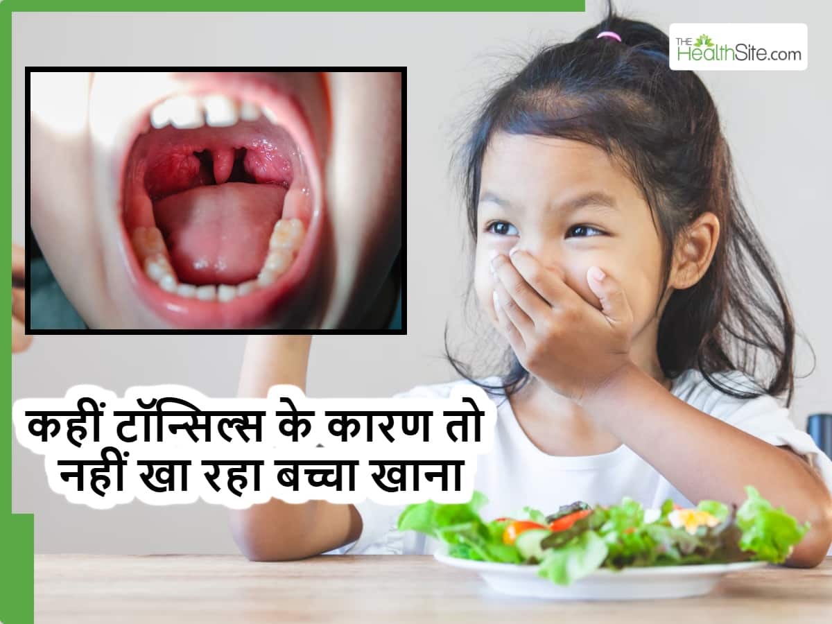Tonsils in Hindi | गले की ये बीमारी होने के कारण पूरी तरह से खाना-पीना ...