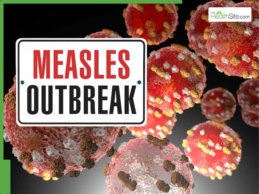Deadly Measles Outbreak Explodes Across US: Texas Becomes Epicenter ...