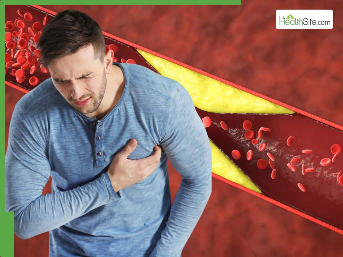 High Cholesterol Symptoms: 5 Warning Indicators Your Body Sends When ...