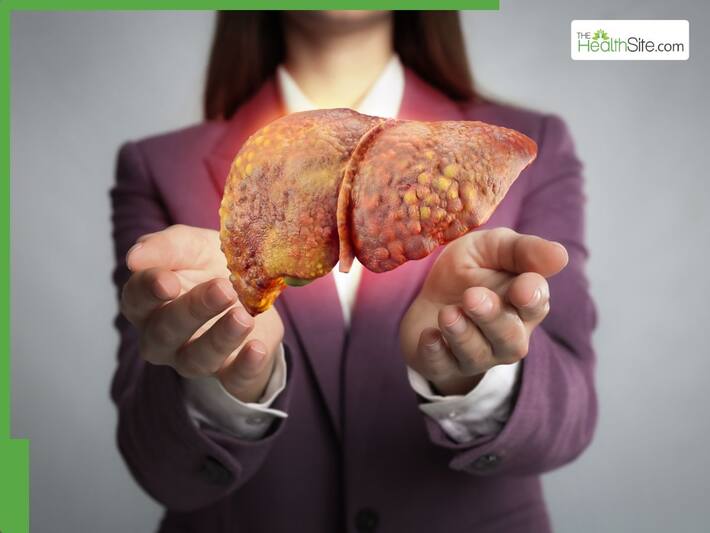 Symptoms Of Terminal Liver Dysfunction: 7 Signs Your Liver Is Dying ...