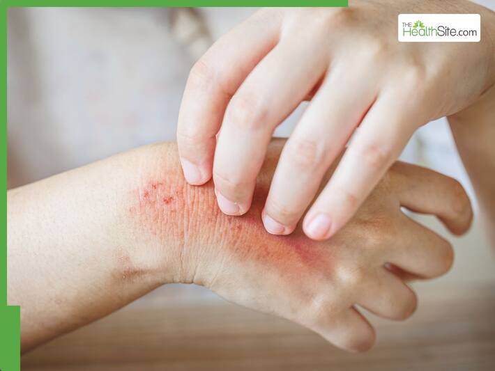 7 Warning Signs of Complete Liver Damage That Appear Only At Night ...