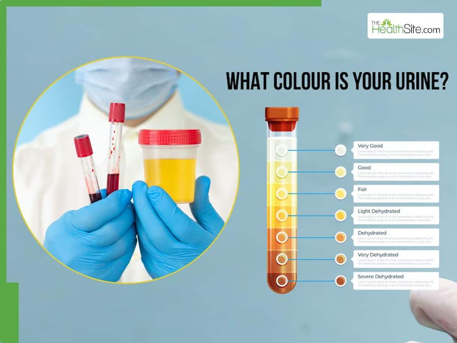 Urine Colour Chart: What the Shade of Your Pee Reveals About Your ...