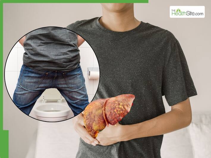 7 Warning Signs of Complete Liver Damage That Appear Only At Night ...