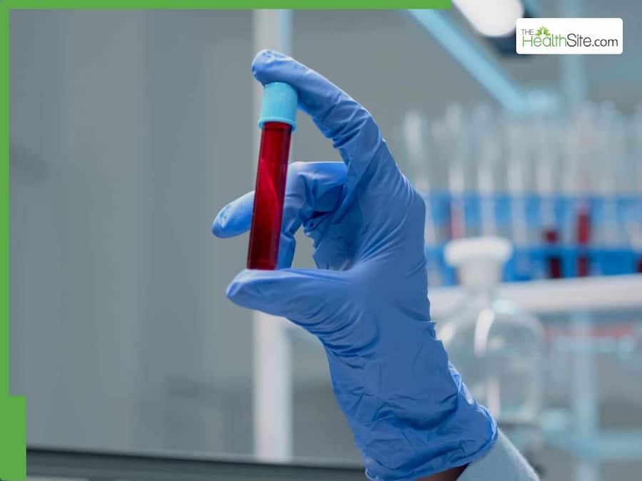 World Hemophilia Day: How To Recognise This Rare Bleeding Disorder ...