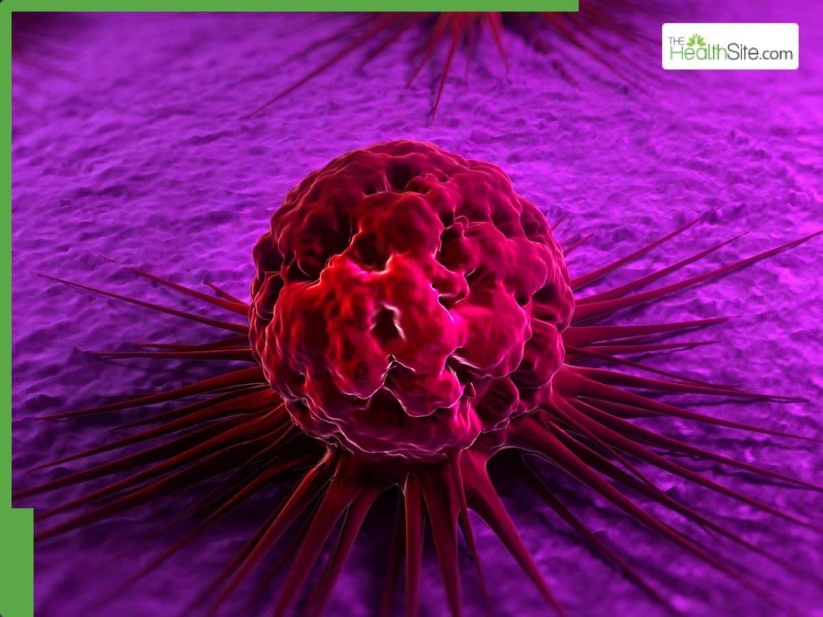 6 Everyday Foods That Are Silently Feeding Cancer In Your Body — Stop ...