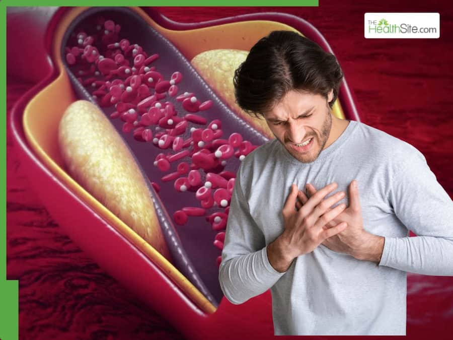 High Cholesterol Symptoms: 10 Warning Signs Your Body's LDL Bad Cholesterol Levels Is Too High ...