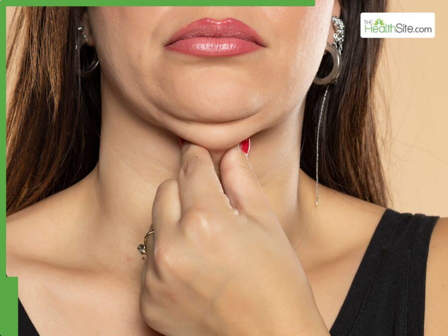 5 Easy Face Exercises You Must Practice Daily To Get Rid of Double Chin | TheHealthSite.com