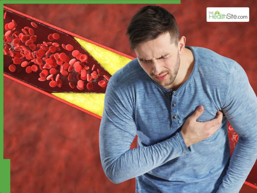 Signs of Poor Heart Health: 1 Month Before a Heart Attack, Your Body ...