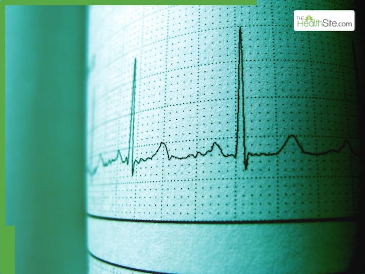 6 Subtle Skin Warning Signs That May Signal An Impending Heart Attack ...