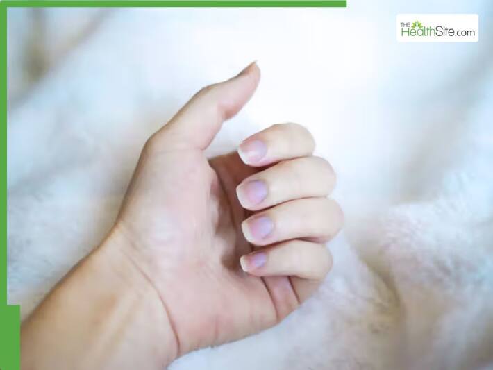 Heart Attack Symptoms: 5 Warning Signs That Appear On Your Nails ...