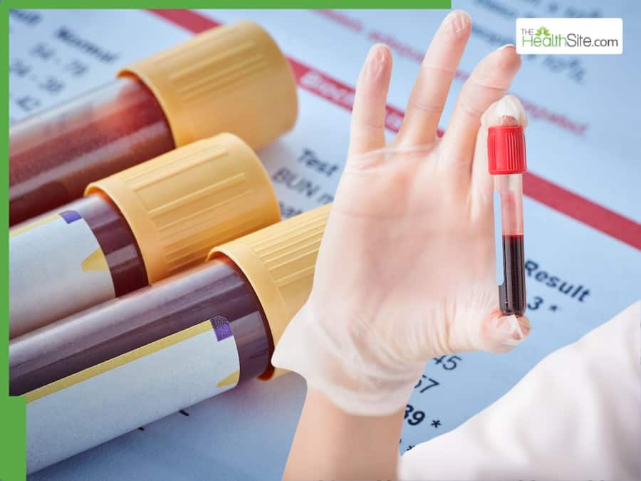 CRIB Blood Group: Indian Woman Becomes First in the World Diagnosed ...