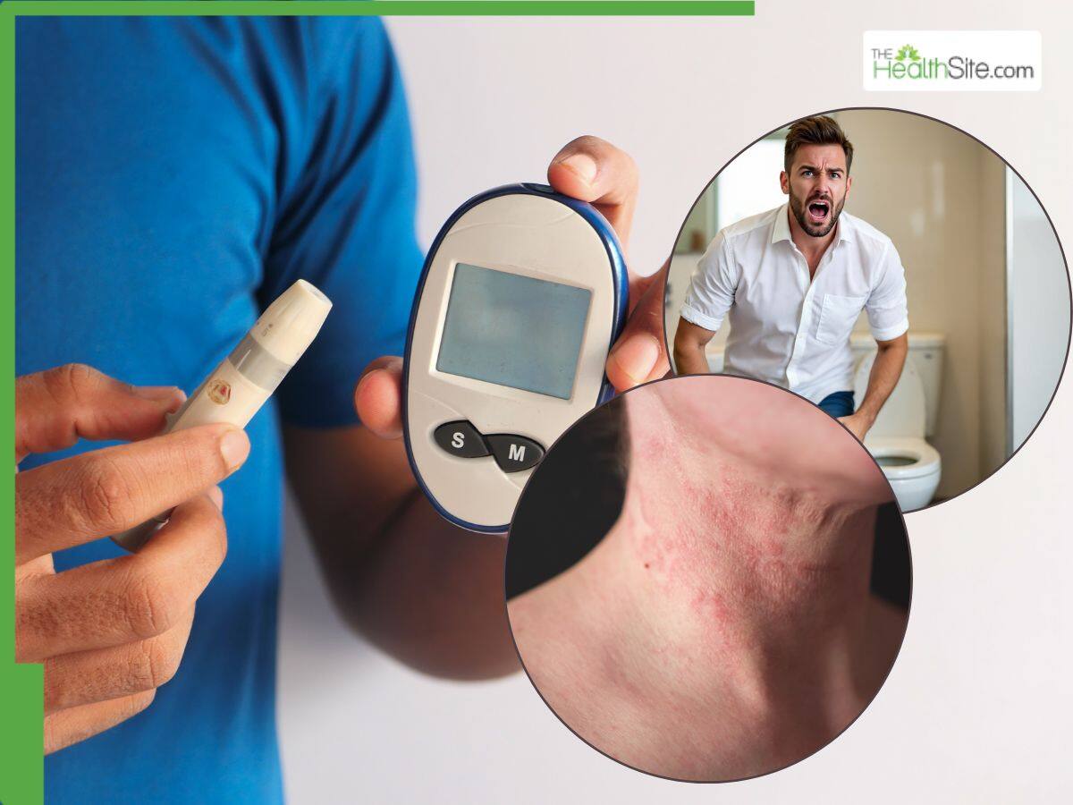 Diabetes Symptoms: 5 Clear Warning Signs Your Blood Sugar Level Is Too ...