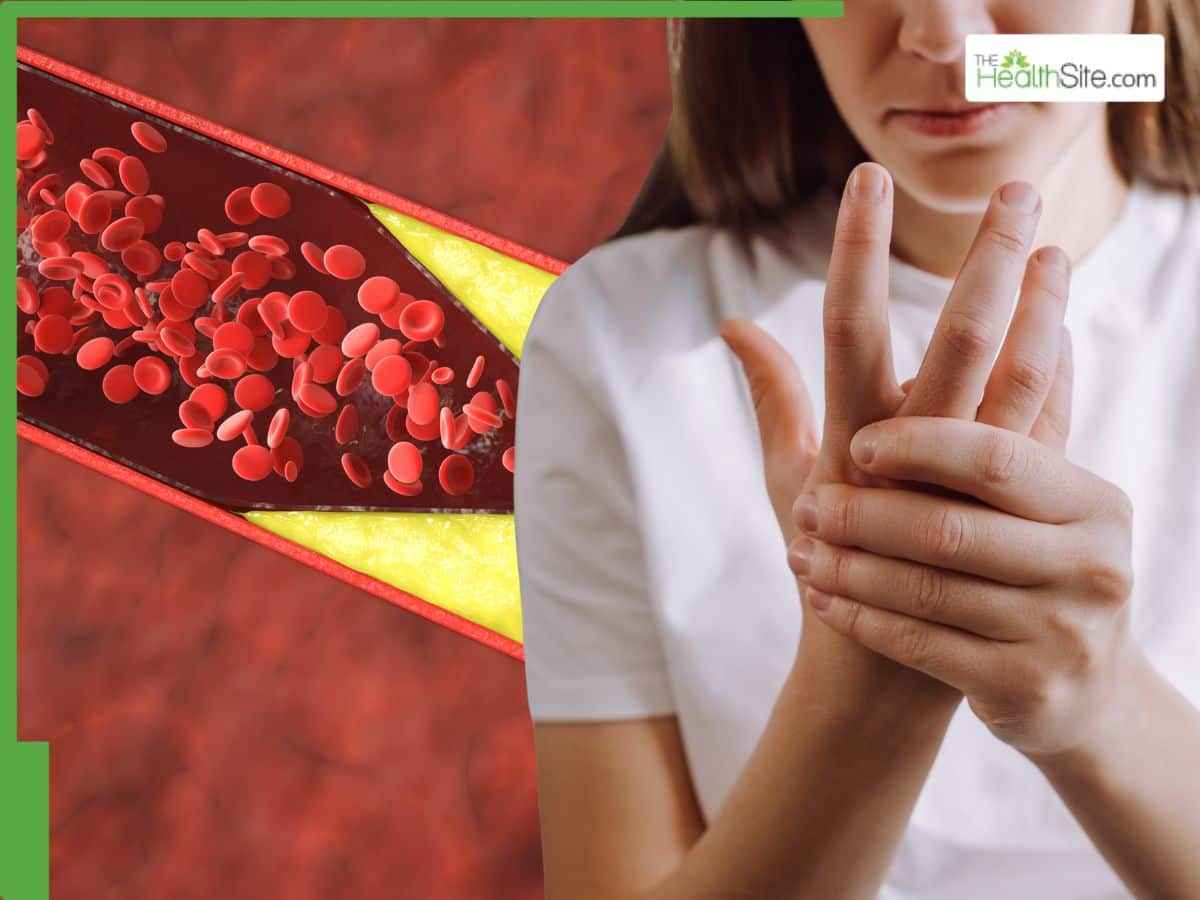 High Cholesterol Symptoms: 7 Warning Signs in Your Fingers That May ...