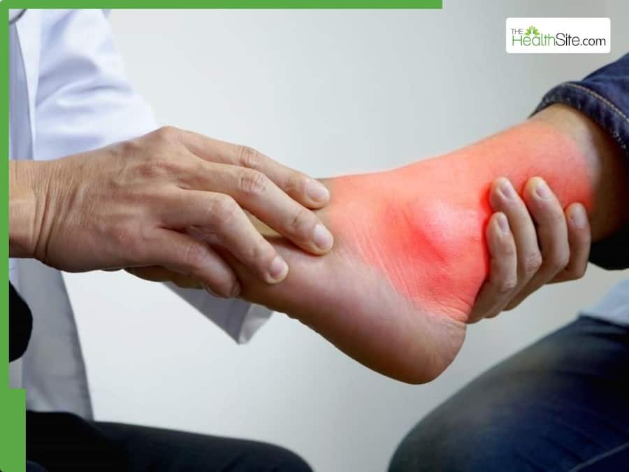 Signs of High Uric Acid in the Body: Warning Symptoms You Shouldn’t ...