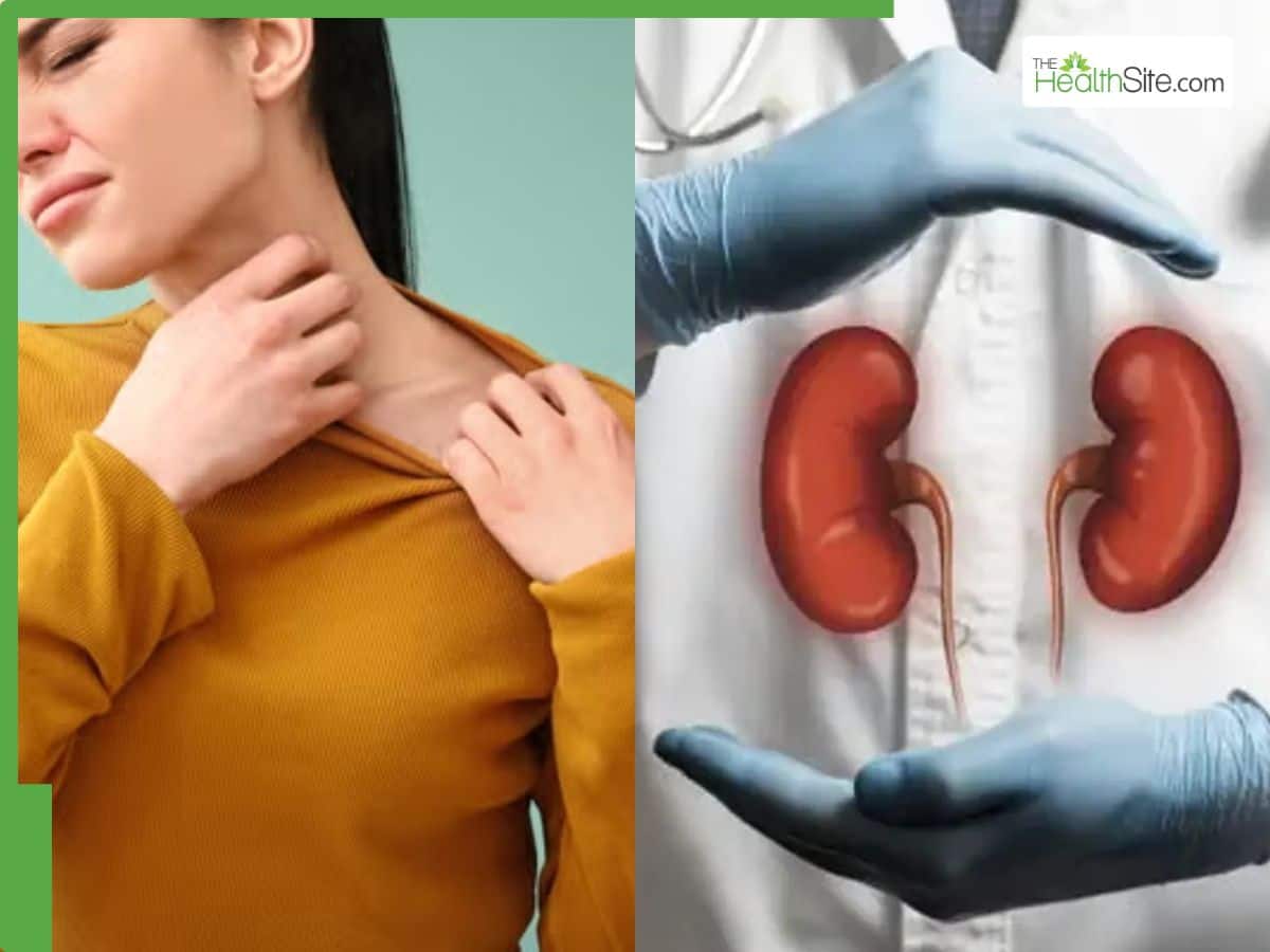 Kidney Disease Symptoms: 6 Early Signs You Can See on Your Face and ...
