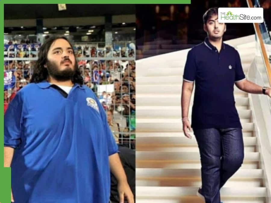 Anant Ambani Weight Loss Journey: How Mukesh Ambani's Son Lost Whopping 108 Kilos In 18 Months ...
