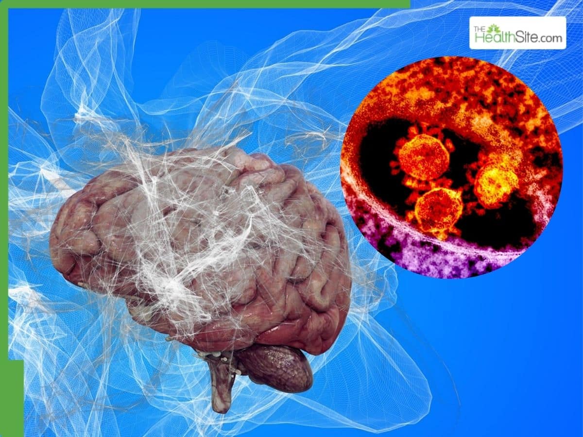 Rare Brain-Eating Amoeba Surges In Kerala; 67 Infected, 18 Dead In ...