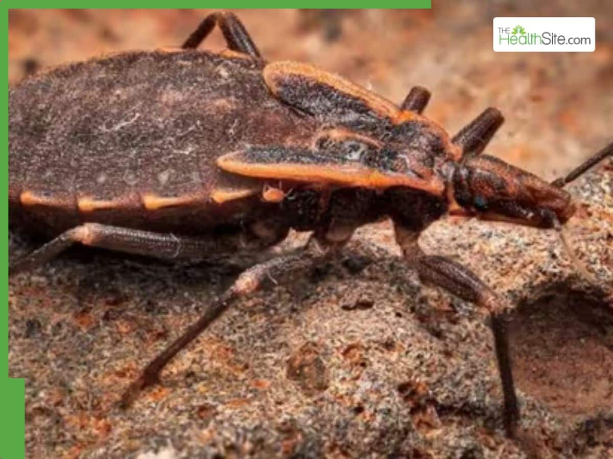 Chagas Disease Spreading Rapidly In US: Everything You Need To Know ...