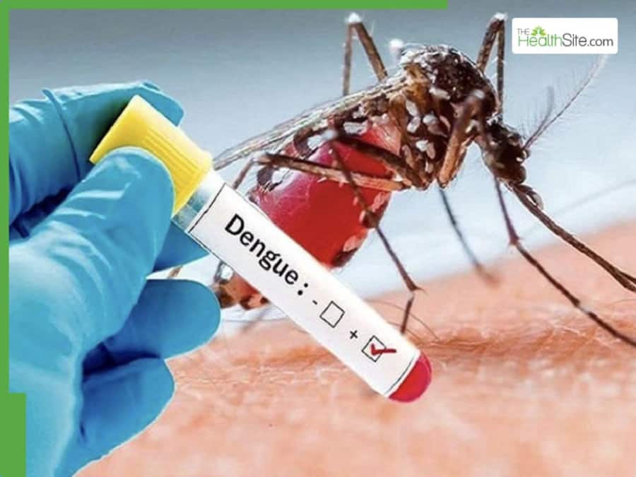 Dengue Warning Signs: 7 Severe Symptoms That Indicate Your Platelet ...